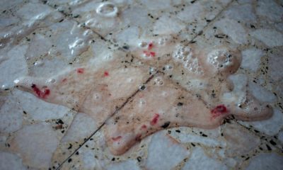 A Cat Vomit Color Chart: What Every Shade Means and When to Worry