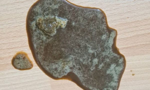 A Cat Vomit Color Chart: What Every Shade Means and When to Worry